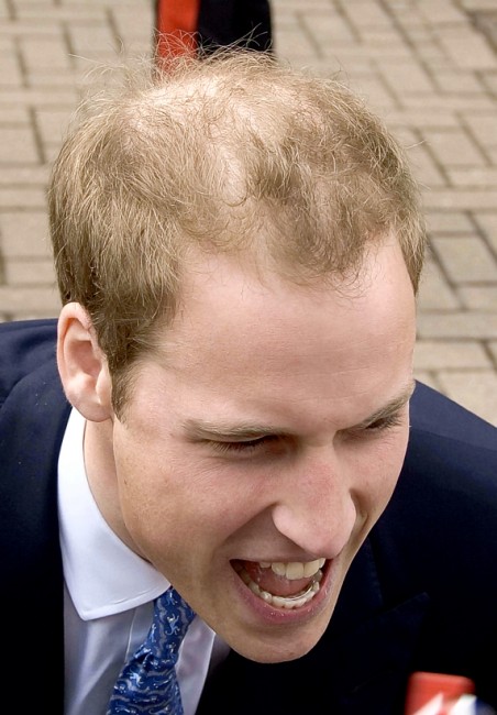 Prince William Bald? | The Velvet Rocket